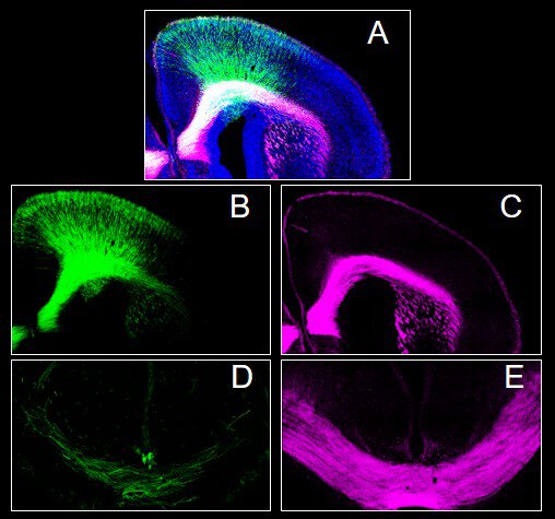 Prenatal downregulation of CB1 cannabinoid receptors in the mouse ...